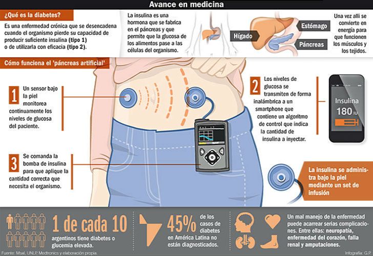 Prueban con éxito un páncreas artificial desarrollado en Argentina ... Prueban con éxito un páncreas artificial desarrollado en Argentina ...