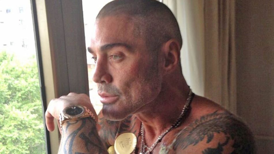 Ricardo Fort debe volver al quirófano | Exitoina