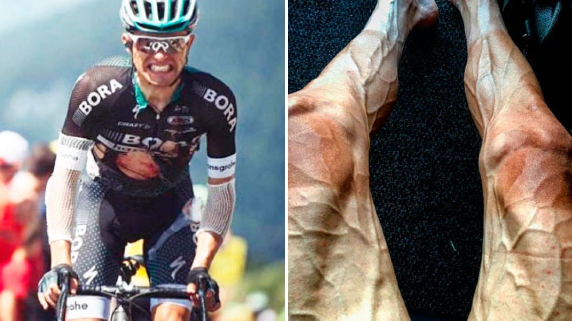 La impactante foto de un ciclista en el Tour de France | 442