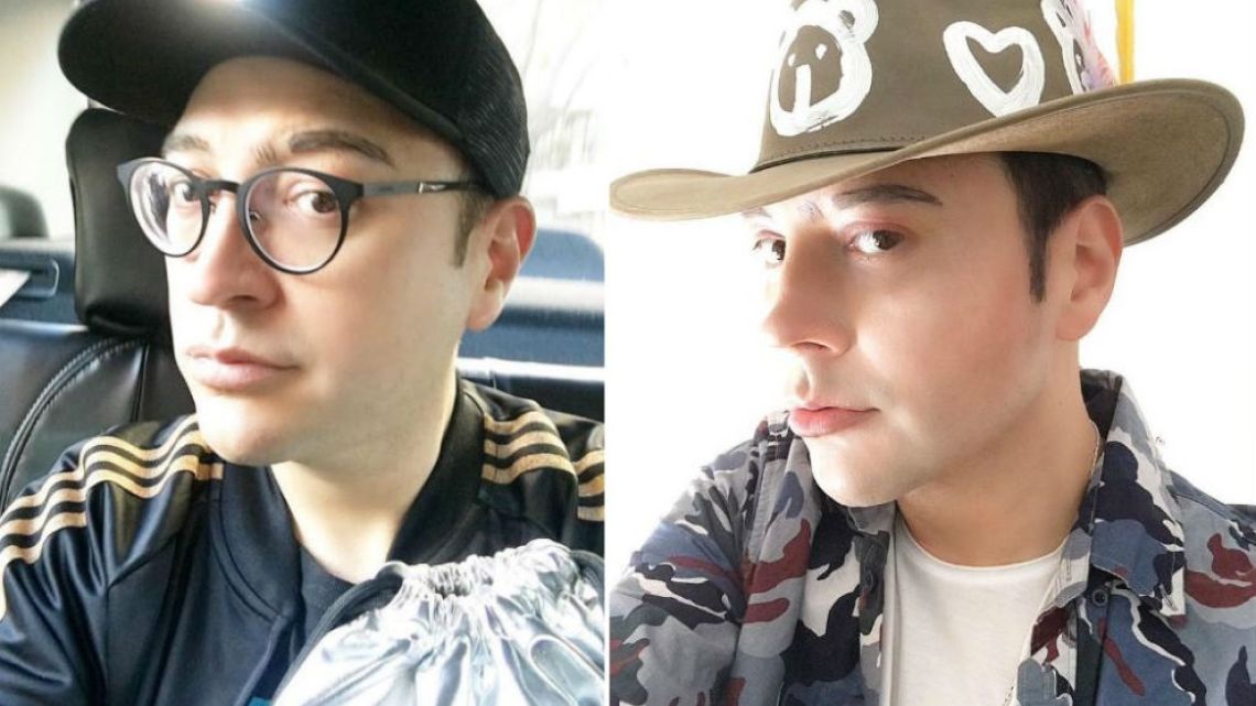 ¡Increíble transformación! Leo García mostró su nuevo rostro | Exitoina