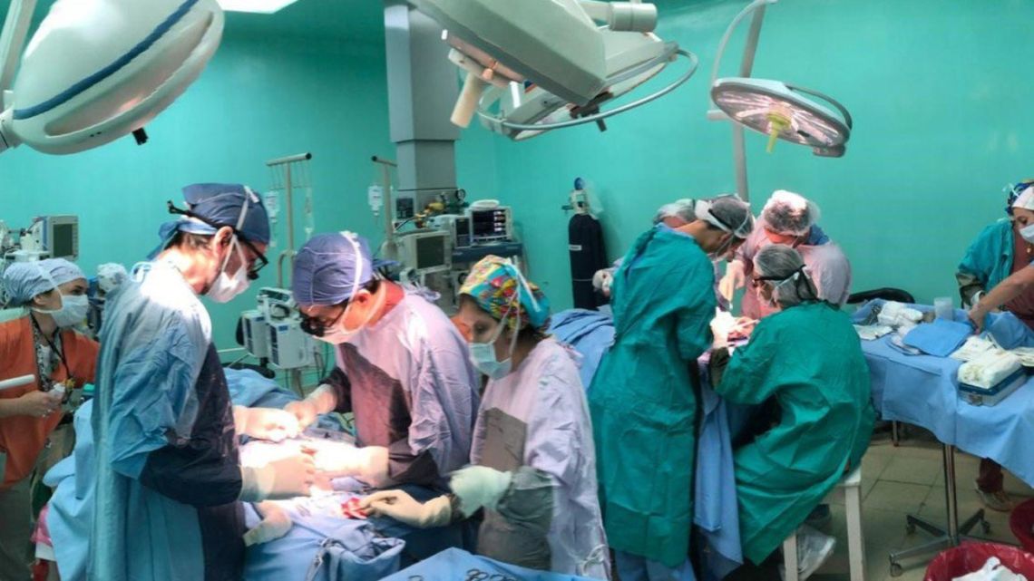 Se realizó la primera cirugía de separación de siameses en un hospital ...