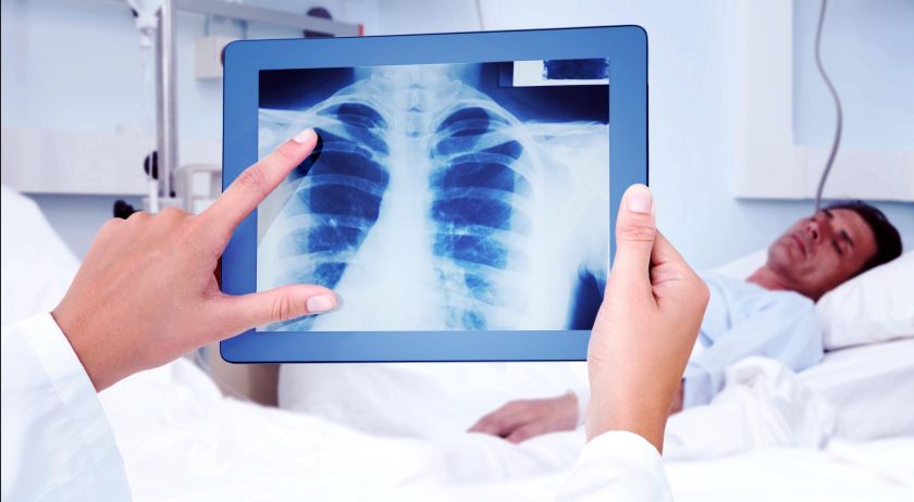 Tuberculosis: cómo se contagia y cuáles son los síntomas | Perfil