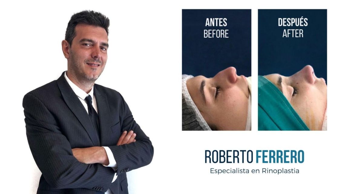 Dr. Roberto Ferrero: pionero en Rinoplastia Ultrasónica en Córdoba | Caras
