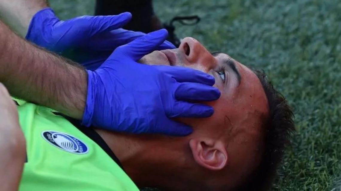 Juan Musso fue operado por una fractura de pómulo: ¿Se perderá el ...