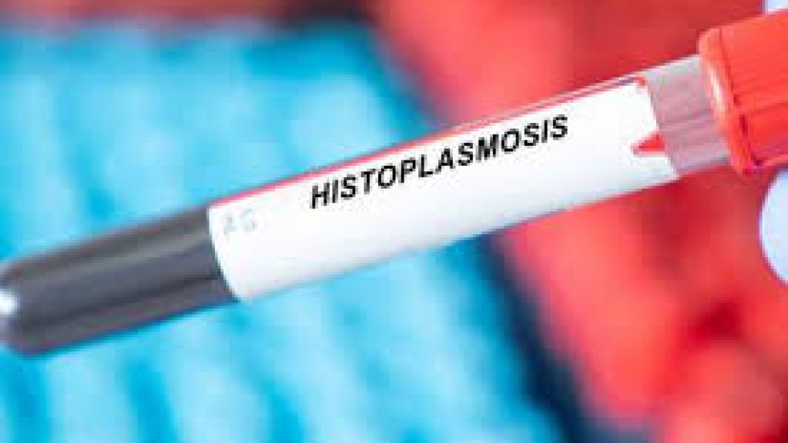Qué es la histoplasmosis, una enfermedad silenciosa y mortal | Perfil