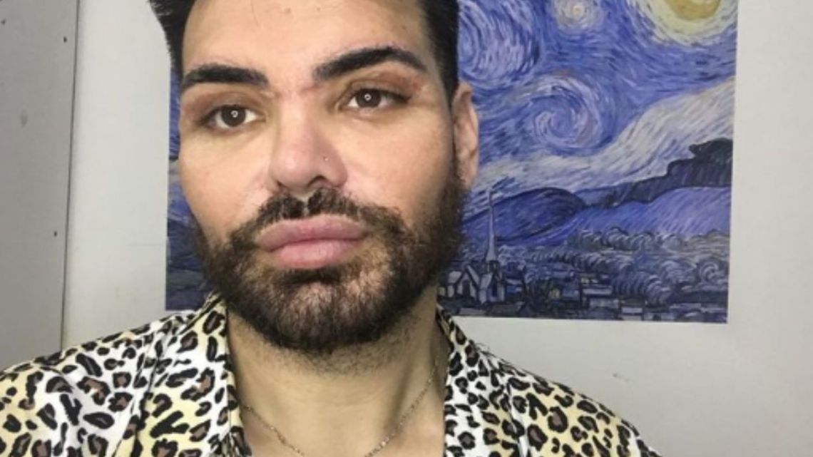 Fran Mariano fue internado de urgencia debido a complicaciones en su ...