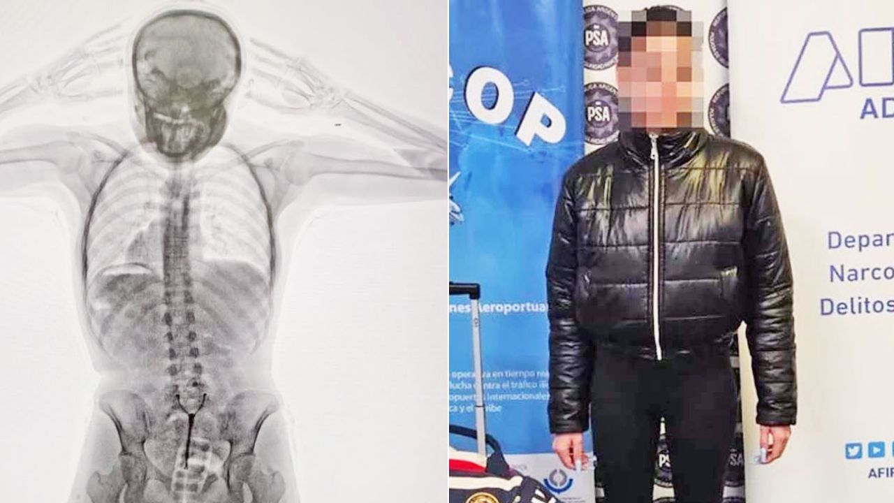 Mula De Piel De Ante