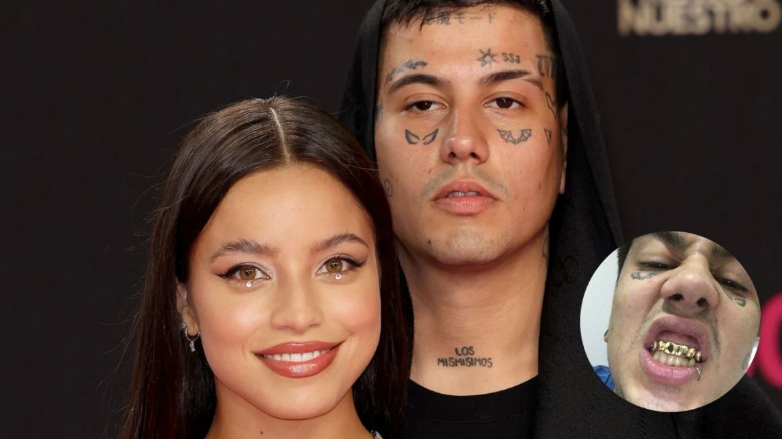 Emilia Mernes fundió los dientes de Duki para hacer un collar | Caras