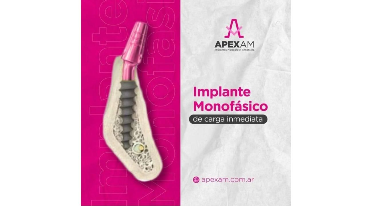 Estética y Funcionalidad: Implantes Monoblock en Mar de las Pampas con ...