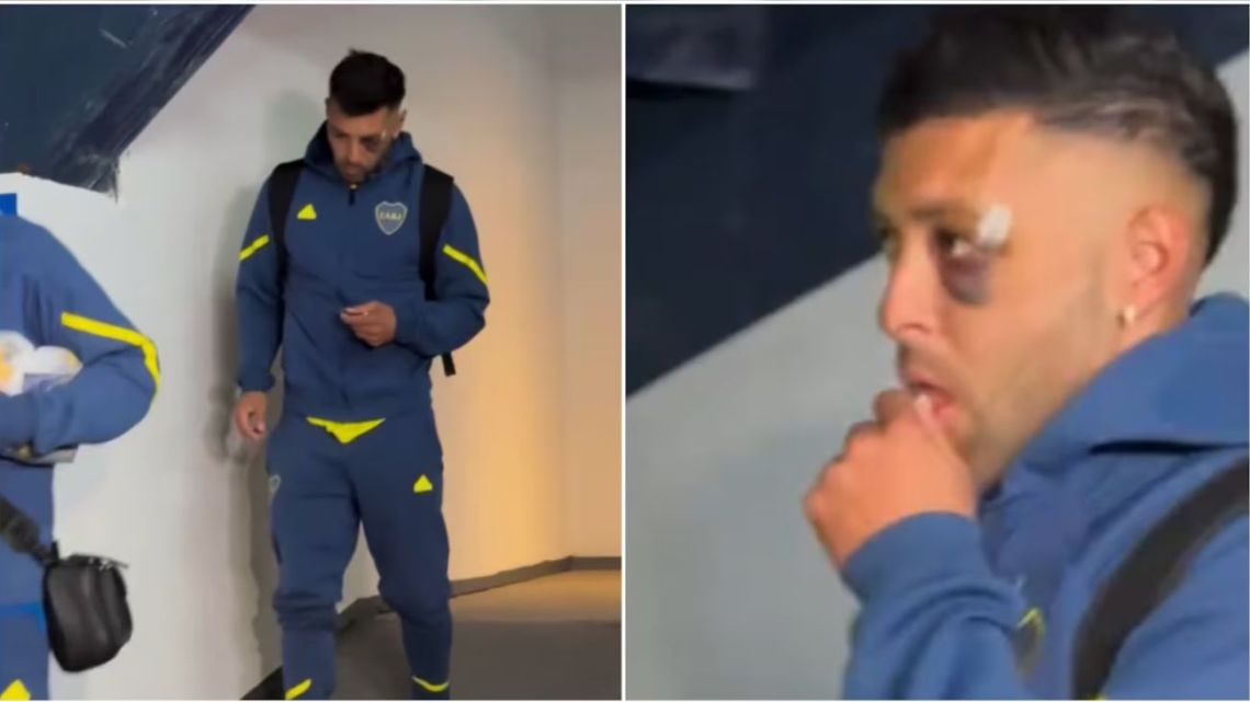 Revelaron el motivo por el que Lucas Janson salió del vestuario con el ojo morado | 442