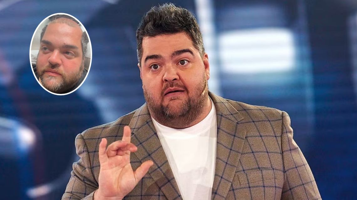 Darío Barassi quedó irreconocible tras un rotundo cambio de look: las ...