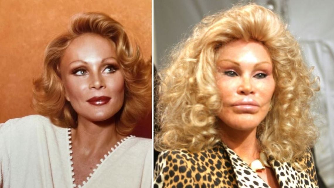 Murió Jocelyne Wildenstein, conocida como "Catwoman" por sus múltiples ...