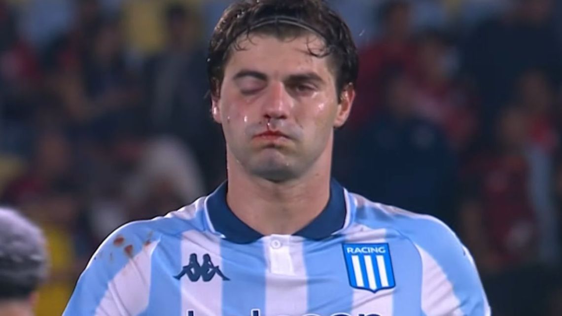 Racing confirmó que Santiago Sosa sufrió una fractura tras un codazo de ...