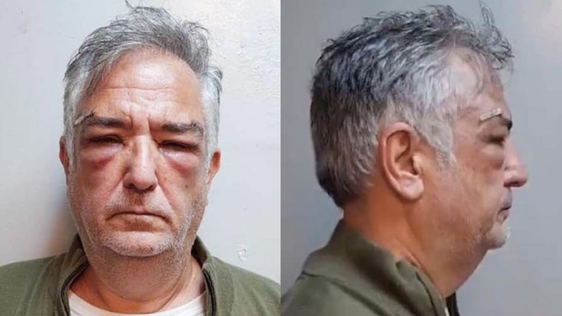 El lado B del caso Calvete: bailarinas, departamentos y explotación ...