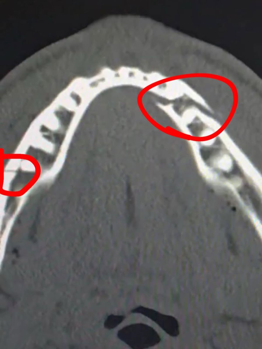 El brutal nocaut de Anthony Joshua sobre el youtuber Jake Paul | 442